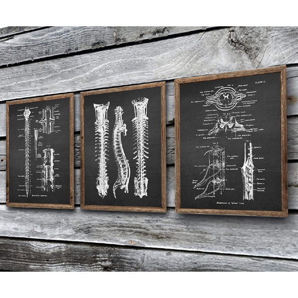 Trinx Neurology Anatomy Of Spinal Cord Backbone - 3 Piece Picture Frame ...